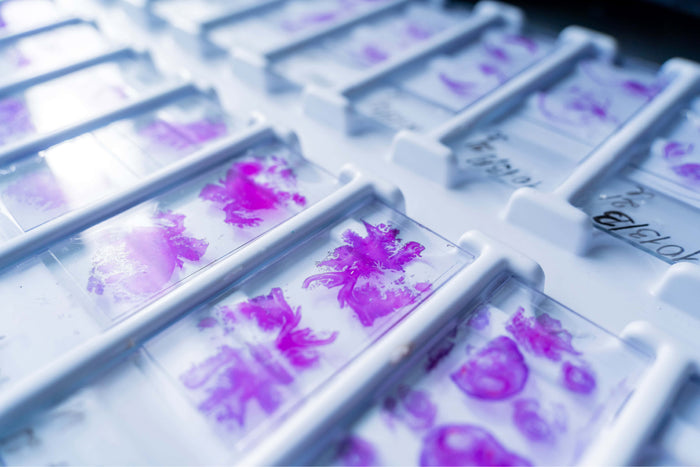 Top 5 Must Have Ihc Reagents For Accurate Diagnostics In Private Pract