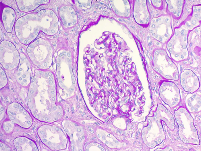Periodic Acid Schiff (PAS) Stain Kit
